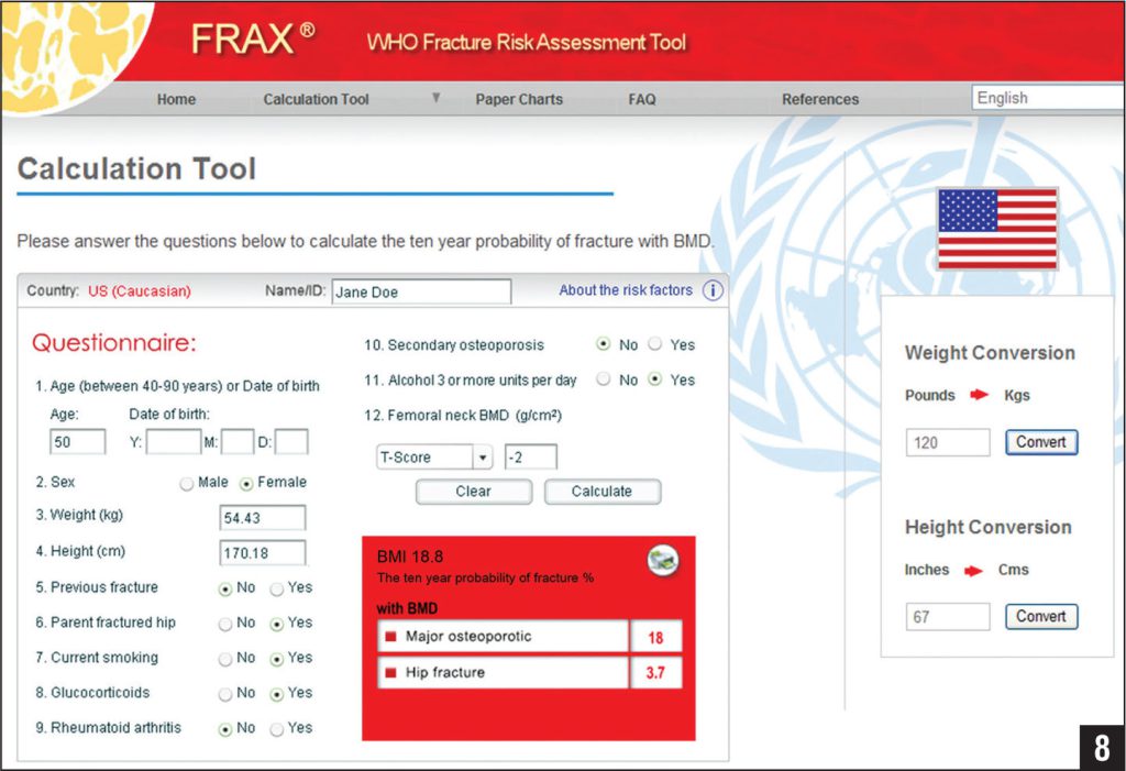 เครื่องมือคำนวณความเสี่ยงการเกิดกระดูกหัก FRAX – สมาคมต่อมไร้ท่อแห่ง ...