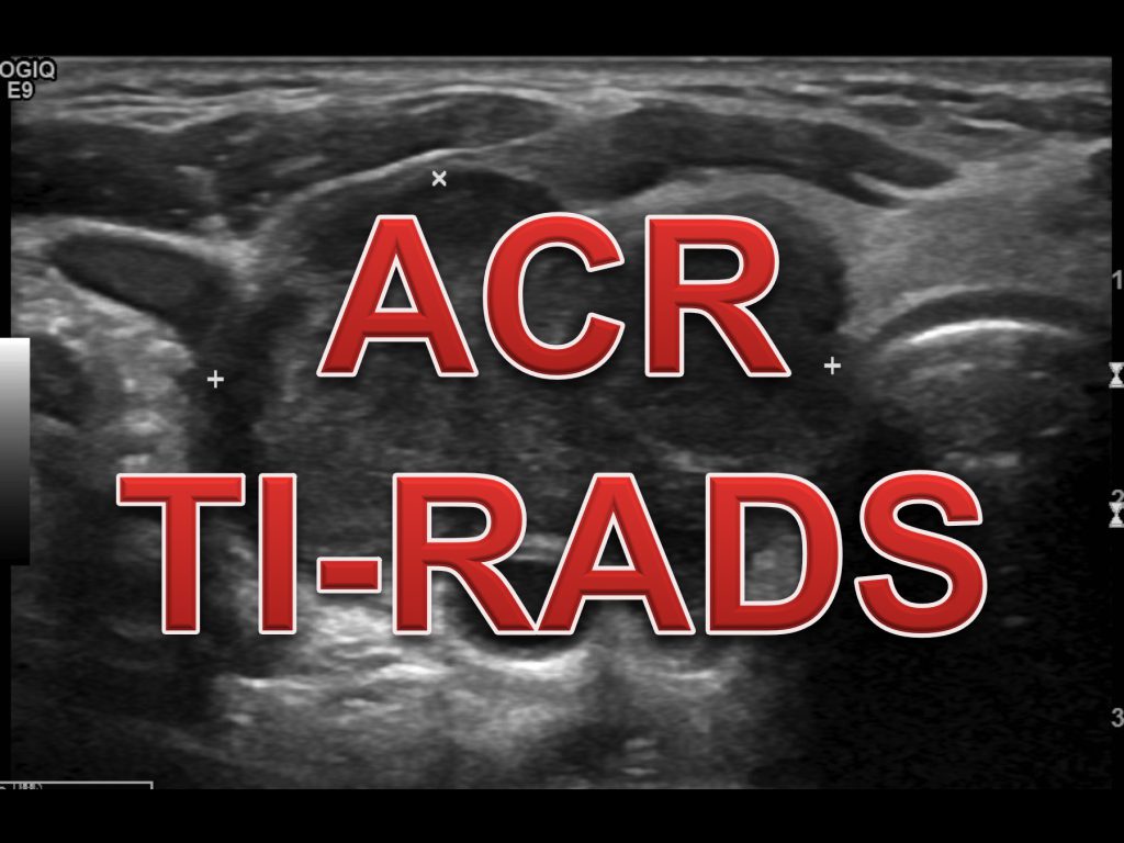 มารู้จักกับ ACR TI-RADS – สมาคมต่อมไร้ท่อแห่งประเทศไทย